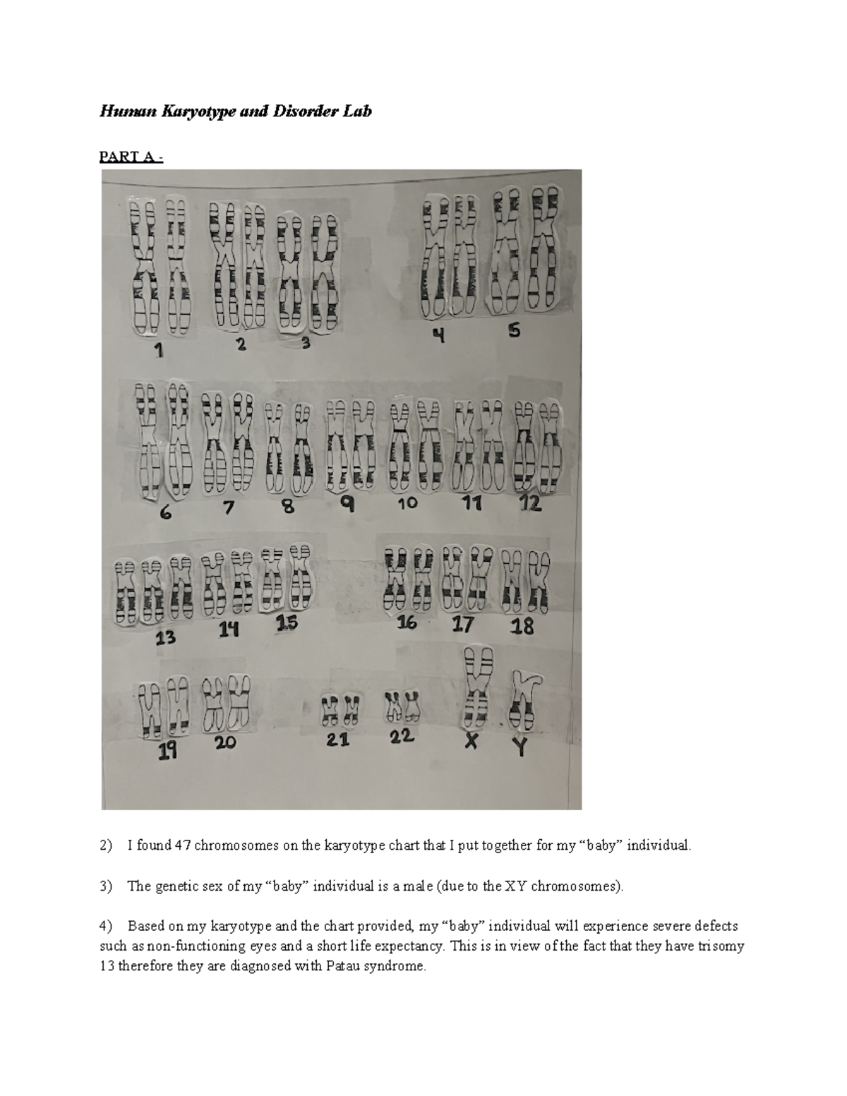 Human Karyotype and Disorder Lab - The genetic sex of my “baby ...