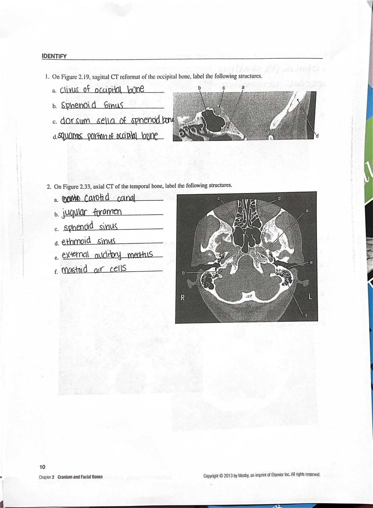 Sec Anat 3 - week 3 - MR001 - Studocu