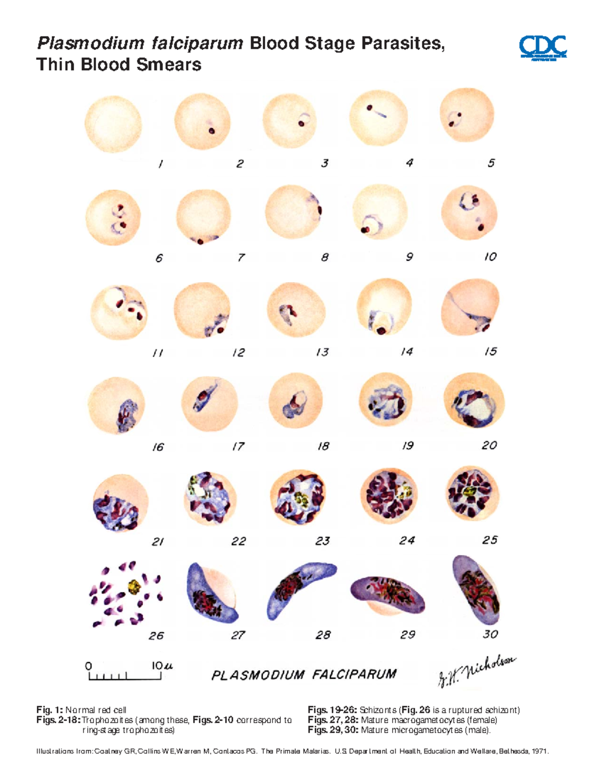 Malaria Comparison p3-6 - Plasmodium falciparum Blood Stage Parasites ...