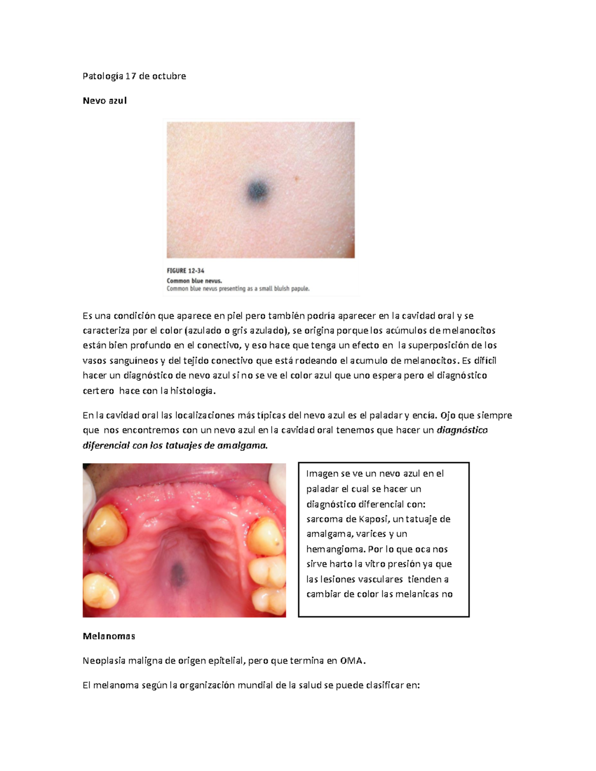 Tipeos de patologia (1) - Patología 17 de octubre Nevo azul Es una ...