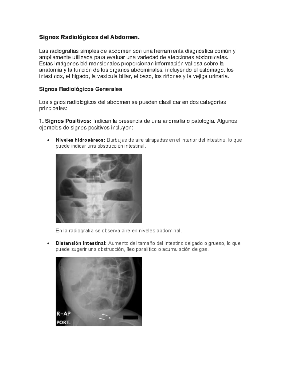 Signos Radiológicos - Las radiografías simples de abdomen son una ...