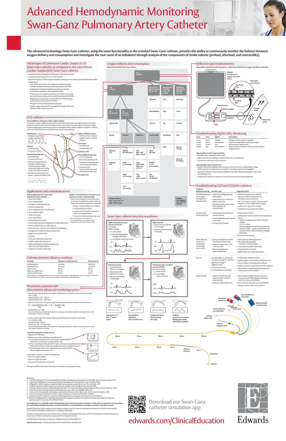 Swan-Ganz Poster (Hybrid) - edwards/ClinicalEducation Download our Swan ...
