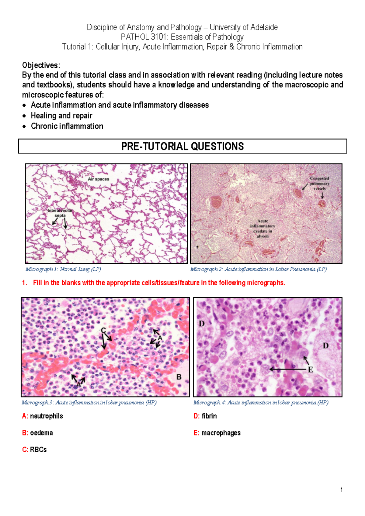 Essentials of Pathology Tutorial: Cellular Injury Acute Inflammation ...
