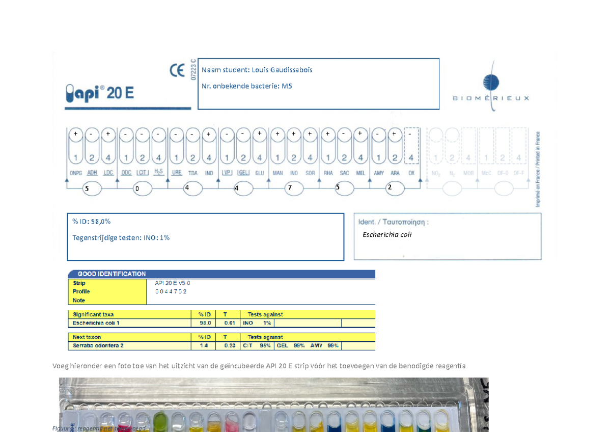 Verslag API 20 E - Voeg hieronder een foto toe van het uitzicht van de geïncubeerde API 20 E ...