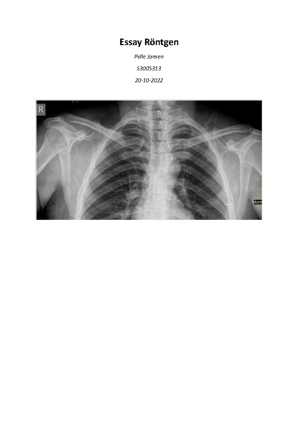Essay Röntgen module 1 - Essay Röntgen Pelle Jansen S 20-10- Ontstaan ...