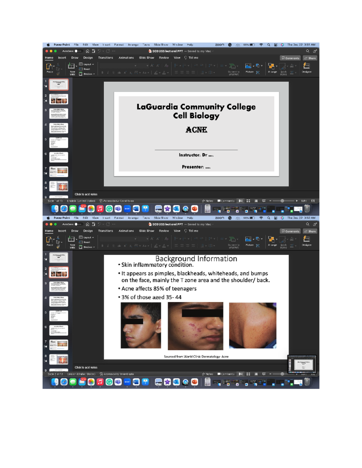 Oral presentation on ACNE - SCB 255 - Studocu
