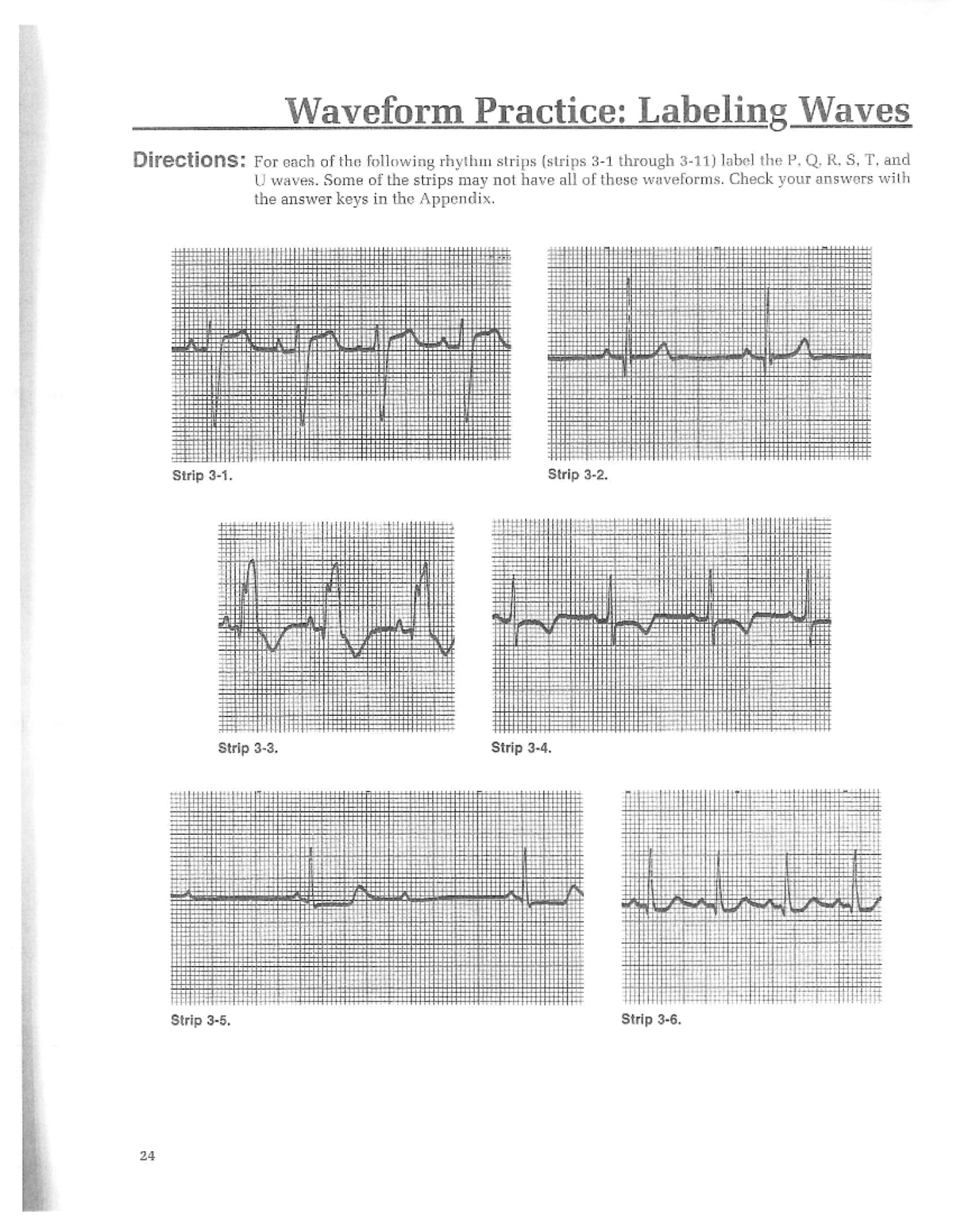 EKG Labeling with Answers - NUR 303 - Studocu
