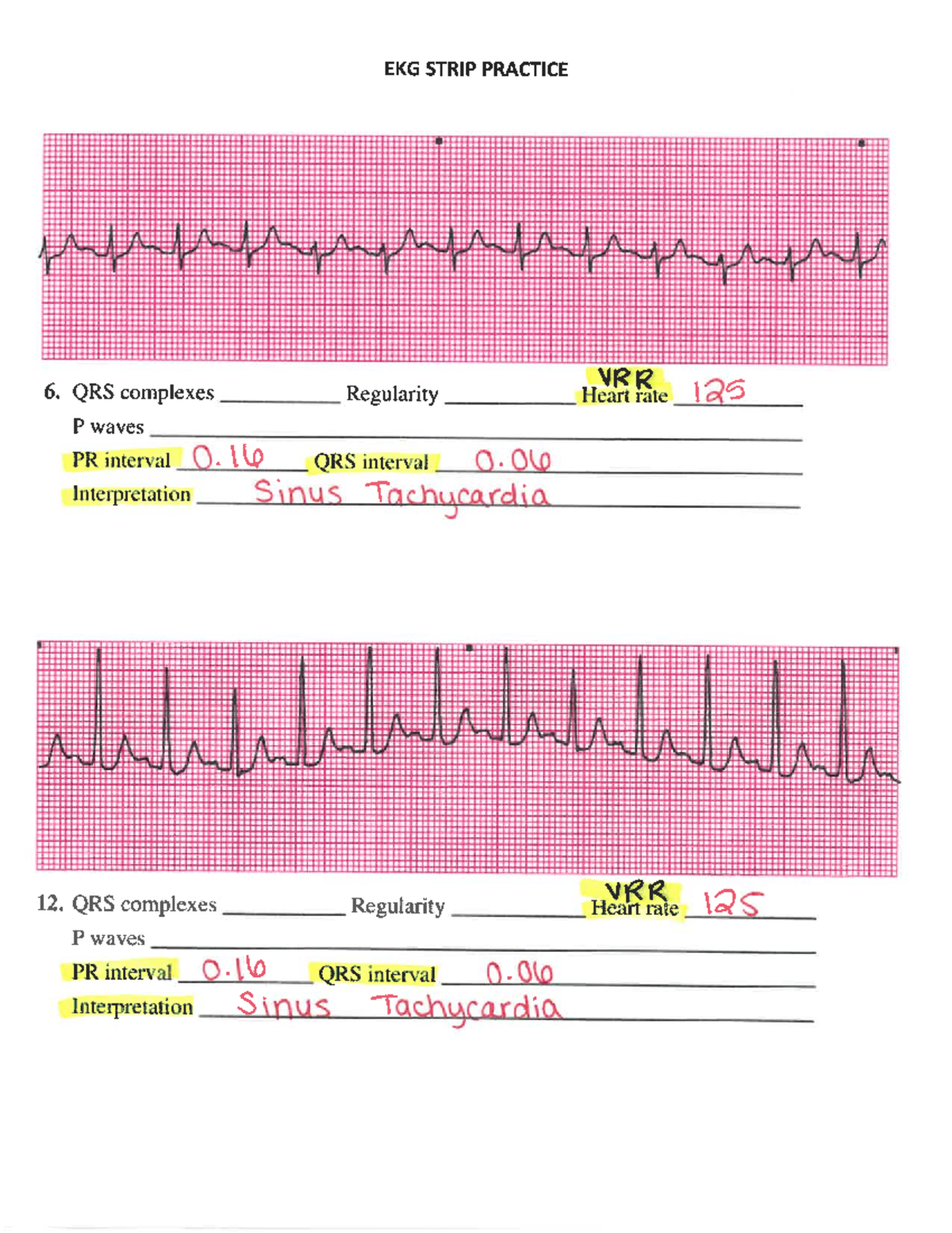 Answers EKG Practice Packet - NUR 255 - Studocu