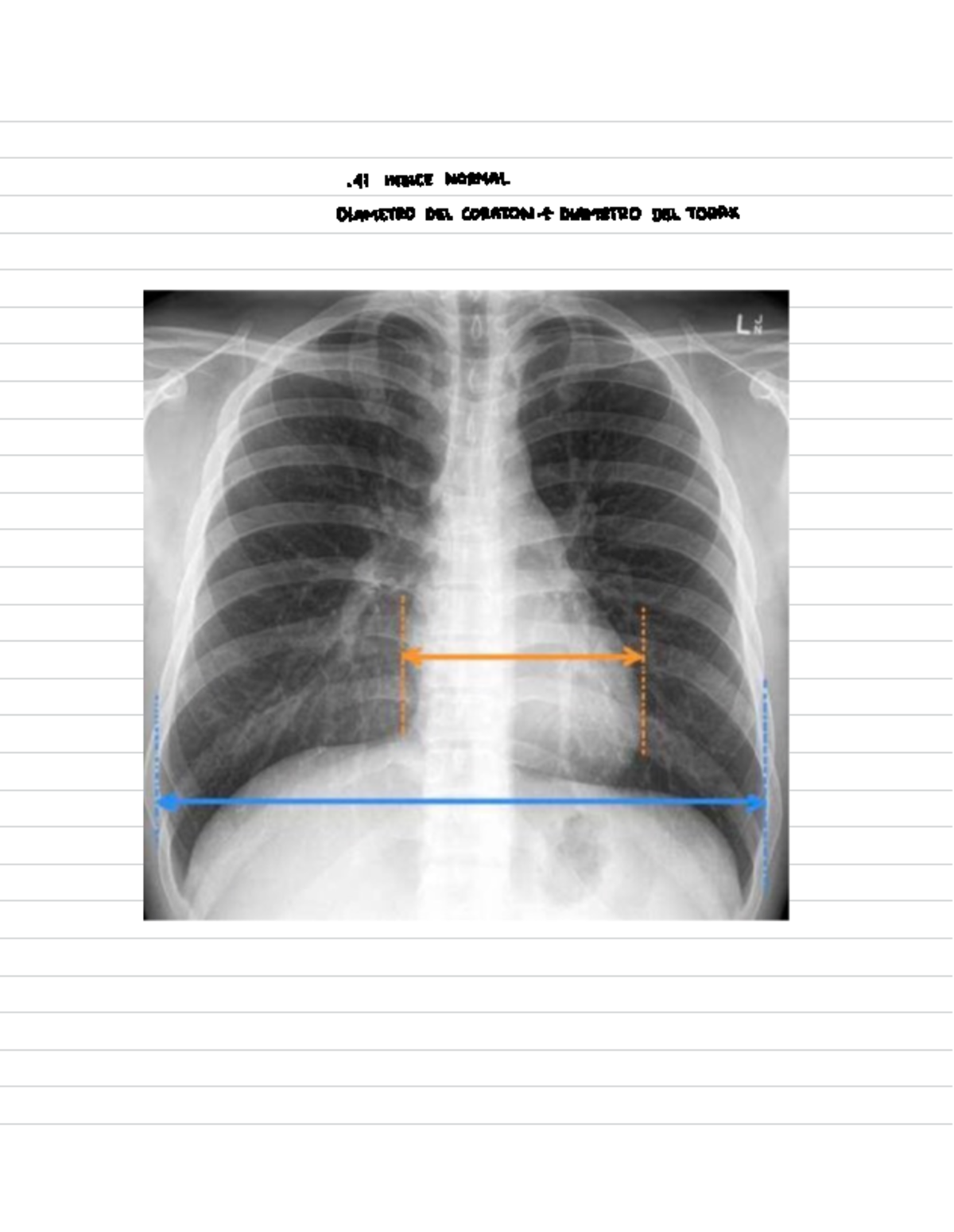 S.C Practica - Medicina - . 11 INDICE NORMAL DIAMETRO DEL CORAZON ...