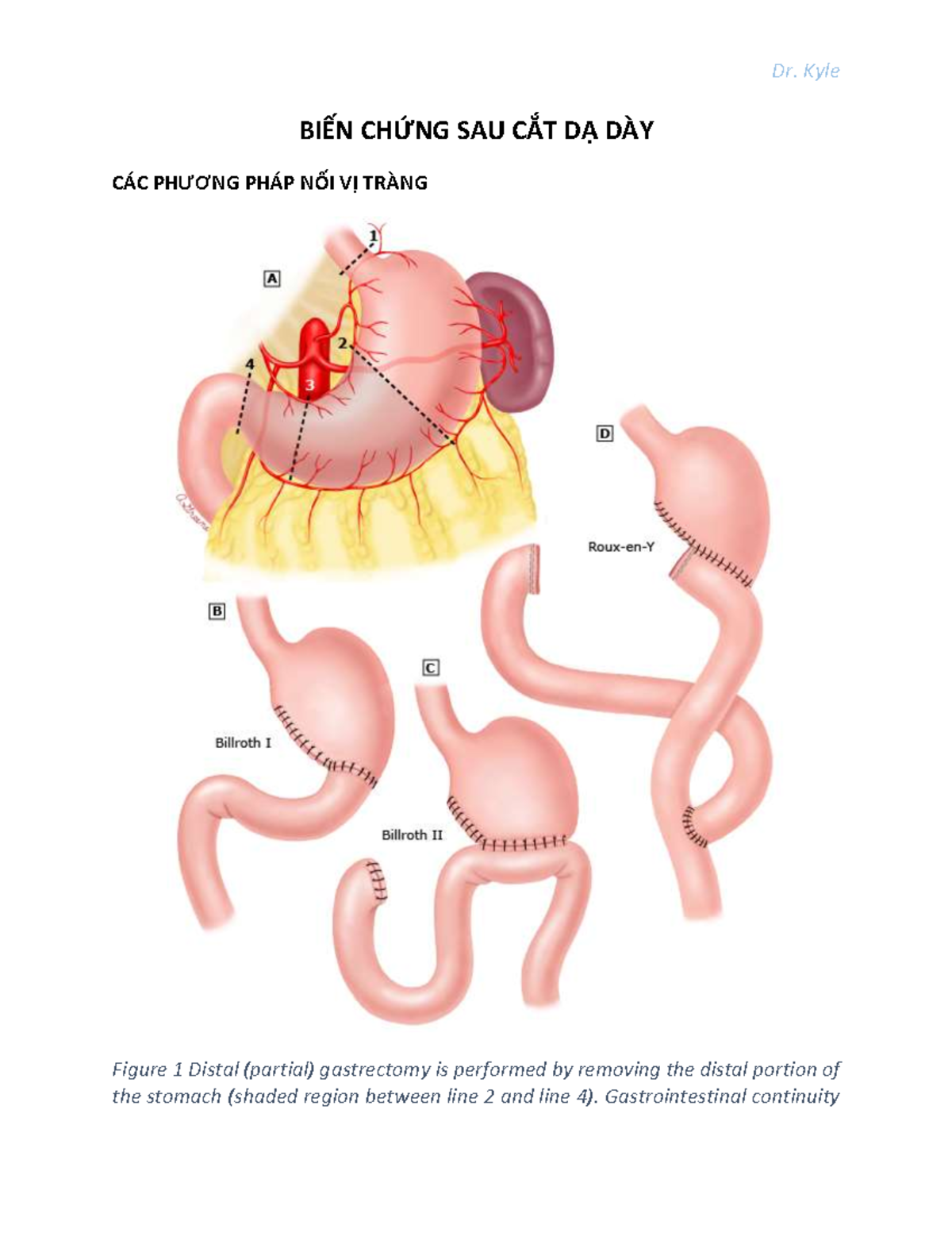 Biến chứng sau cắt dạ dày - BIẾN CHỨNG SAU CẮT DẠ DÀY CÁC PHƯƠNG PHÁP ...