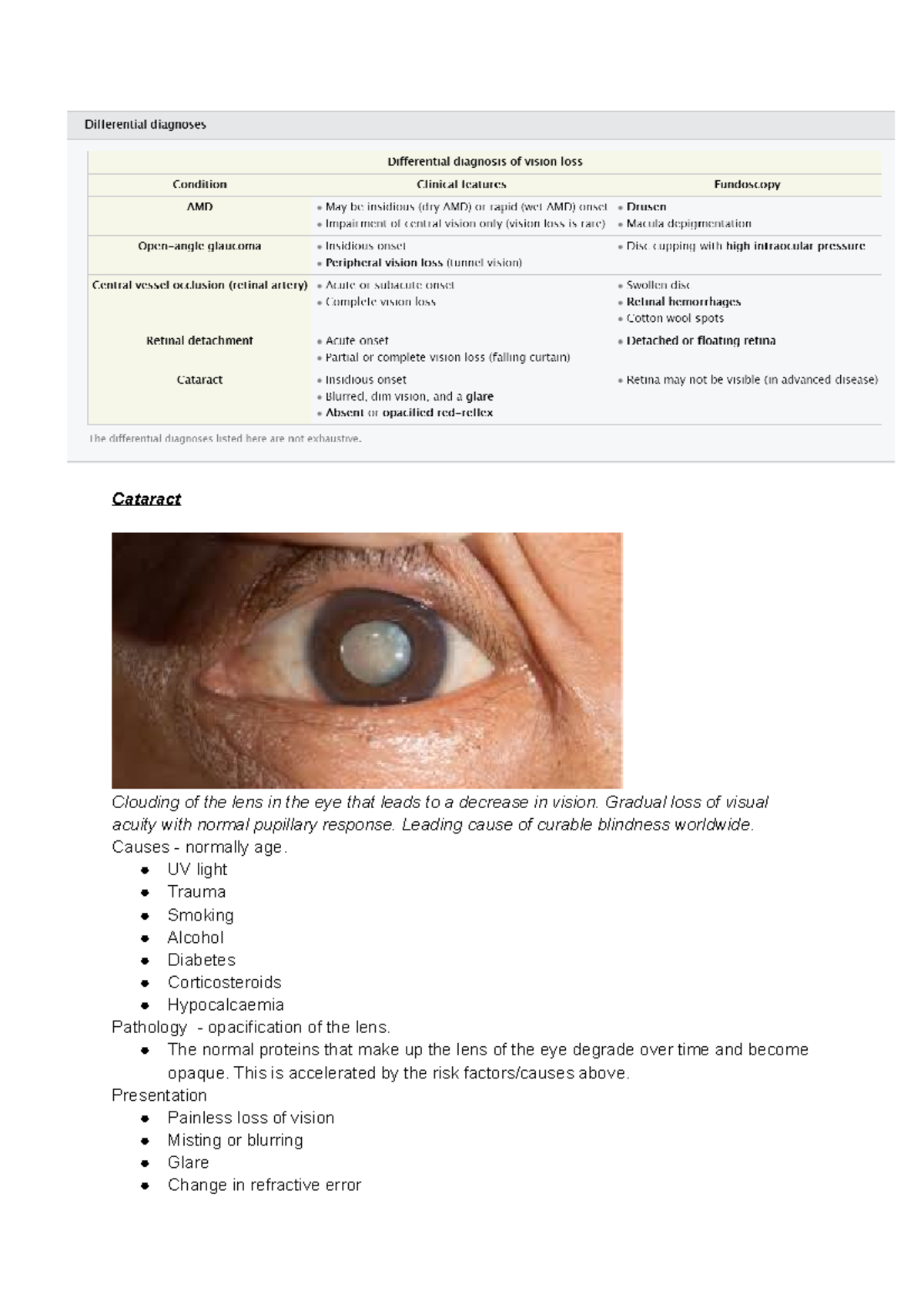Cataract - Lecture notes Year 4 Opthalmology - Cataract Clouding of the ...