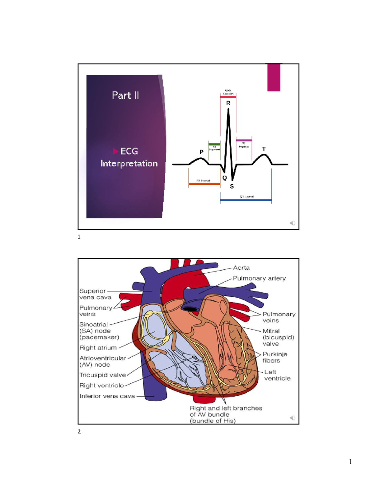 Audio part 2 ecg - nursing notes - Part II ECG Interpretation ####### 1 ...