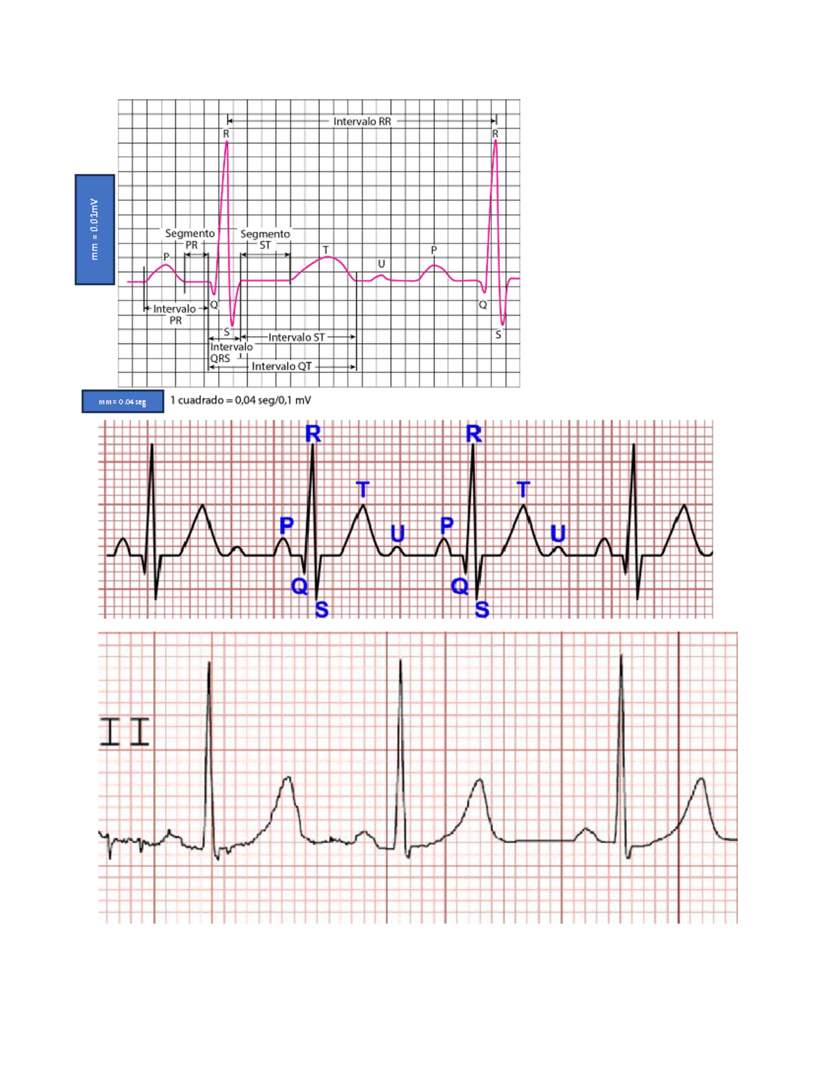 Ejercicio ECG - 0 - Fisiología - Intervalo RR R R Segmento Segmento PR ...
