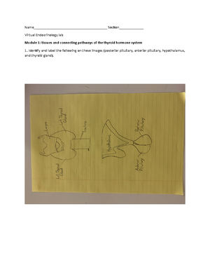 Sickle Cell Anemia. Worksheet SP20-1-3 - BIOL 112 Lab 8. Sickle Cell ...