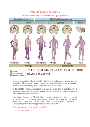 Distúrbios da Marcha e Suas Causas - Tipos de marcha Marcha Hemiplégica ...