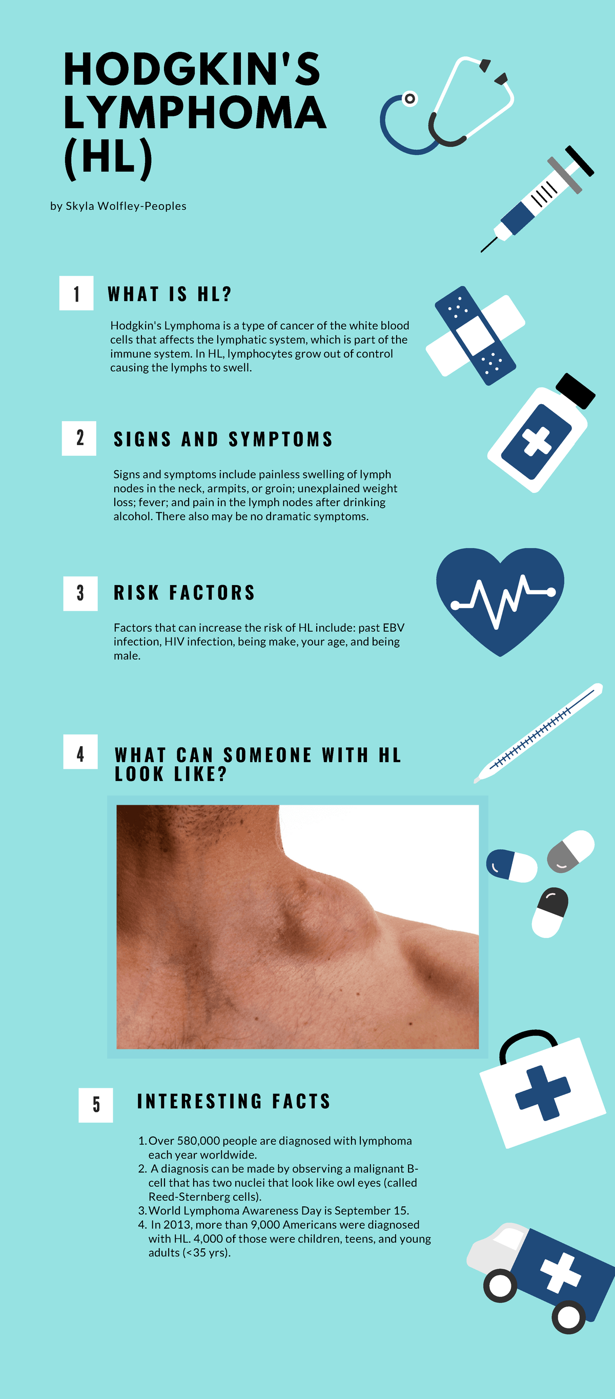 HL Info - Hodgkin lymphoma - 1 W H A T I S H L? Hodgkin's Lymphoma is a ...
