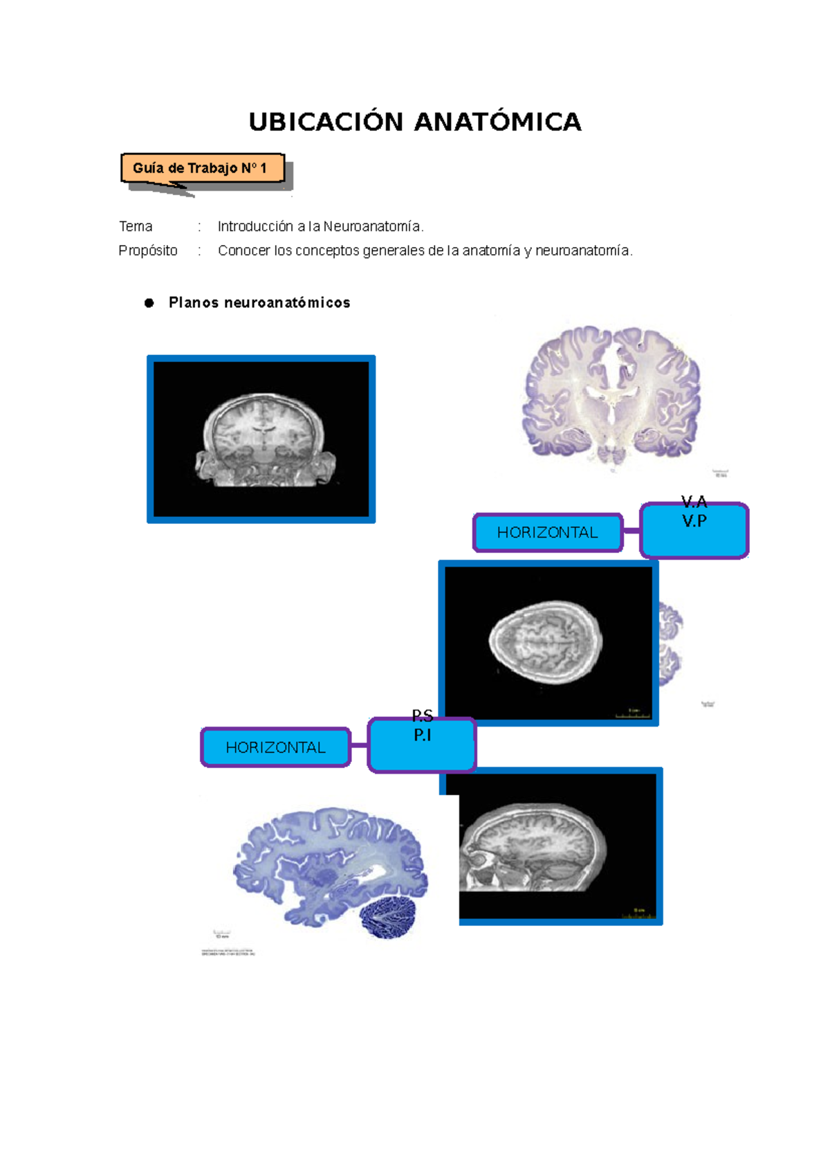 Neuroanatomia básica - UBICACIÓN ANATÓMICA Tema : Introducción a la ...