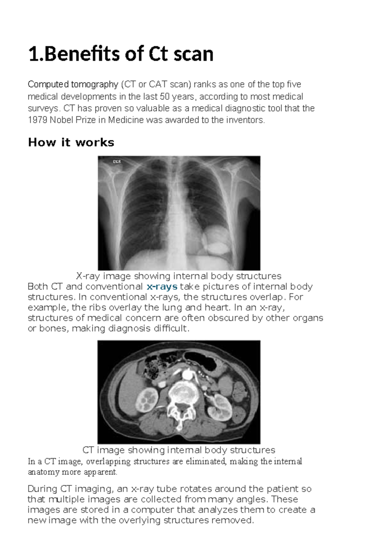 Ct scan benefit - 1 of Ct scan Computed tomography (CT or CAT scan ...