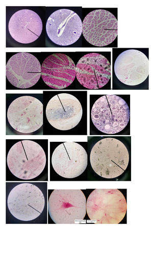 Handout for Urinalysis Interpretation: Microscopic and Macroscopic Exam ...