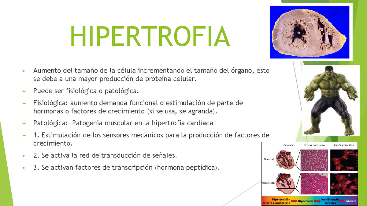 Hipertrofia e hiperplasia - HIPERTROFIA Aumento del tamaño de la célula ...