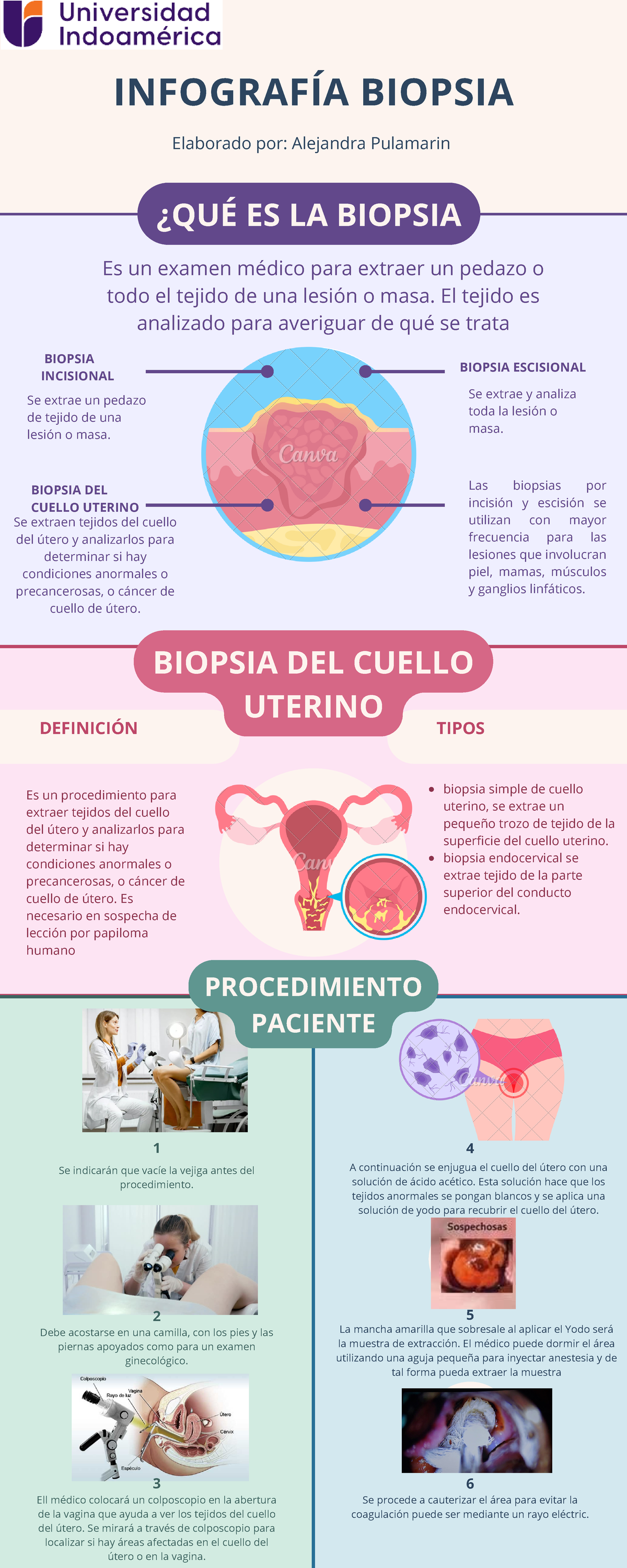 Infografia Biopsia- Uroflujometria - BIOPSIA INCISIONAL BIOPSIA ...