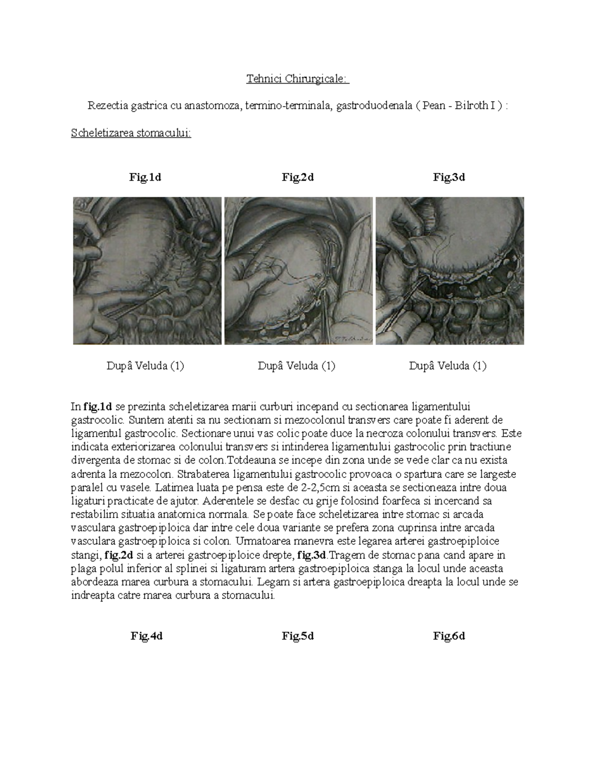 Rezectii gastrice - tratamentul cancerului gastric - Tehnici ...