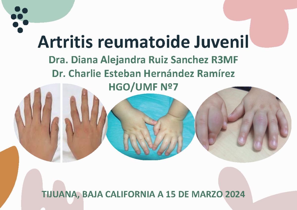 Artritis reumatoide juvenil Diana - copia - Artritis reumatoide Juvenil ...