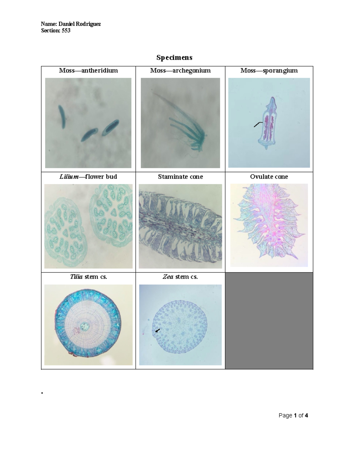 Finished lab 5 plants - Section: 553 Specimens Moss—antheridium Moss ...