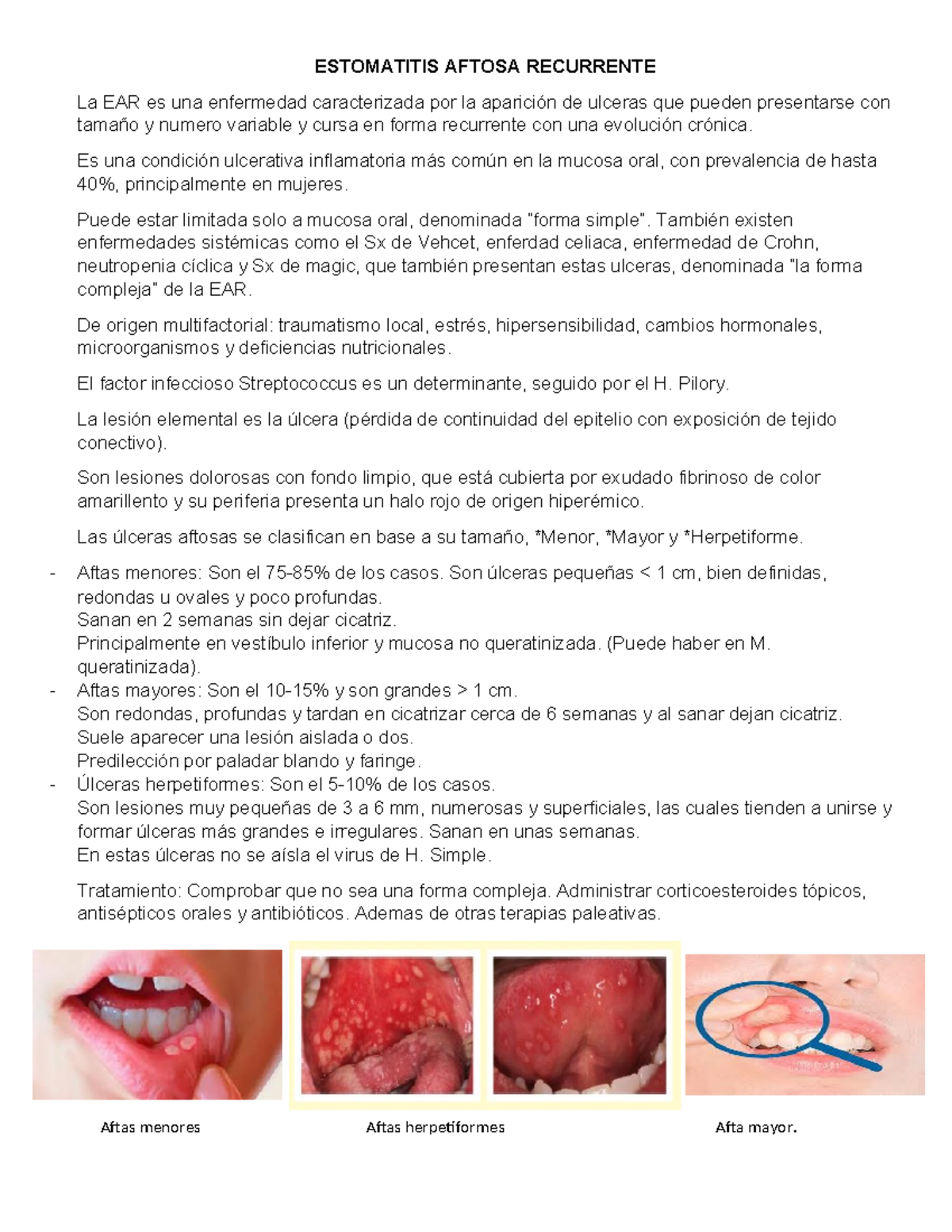 Estomatitis Aftosa Recurrente - ESTOMATITIS AFTOSA RECURRENTE La EAR es ...