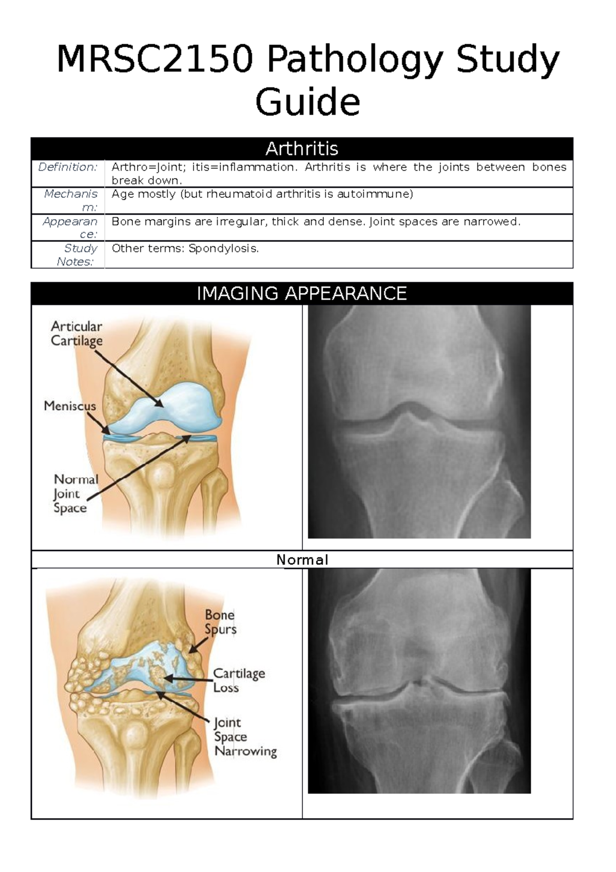 Pathology Study Guide - Guide Arthritis Definition: Arthro=Joint; itis ...