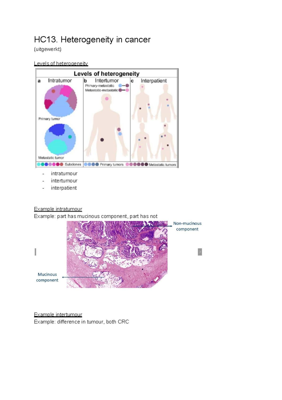 HC13.heterogeneity in cancer - HC13. Heterogeneity in cancer ...