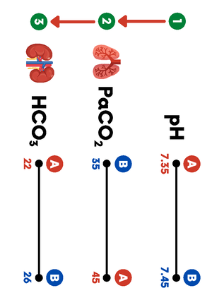 ECG Flowchart - ECG interpretation made easy - Assess the rate Divide ...