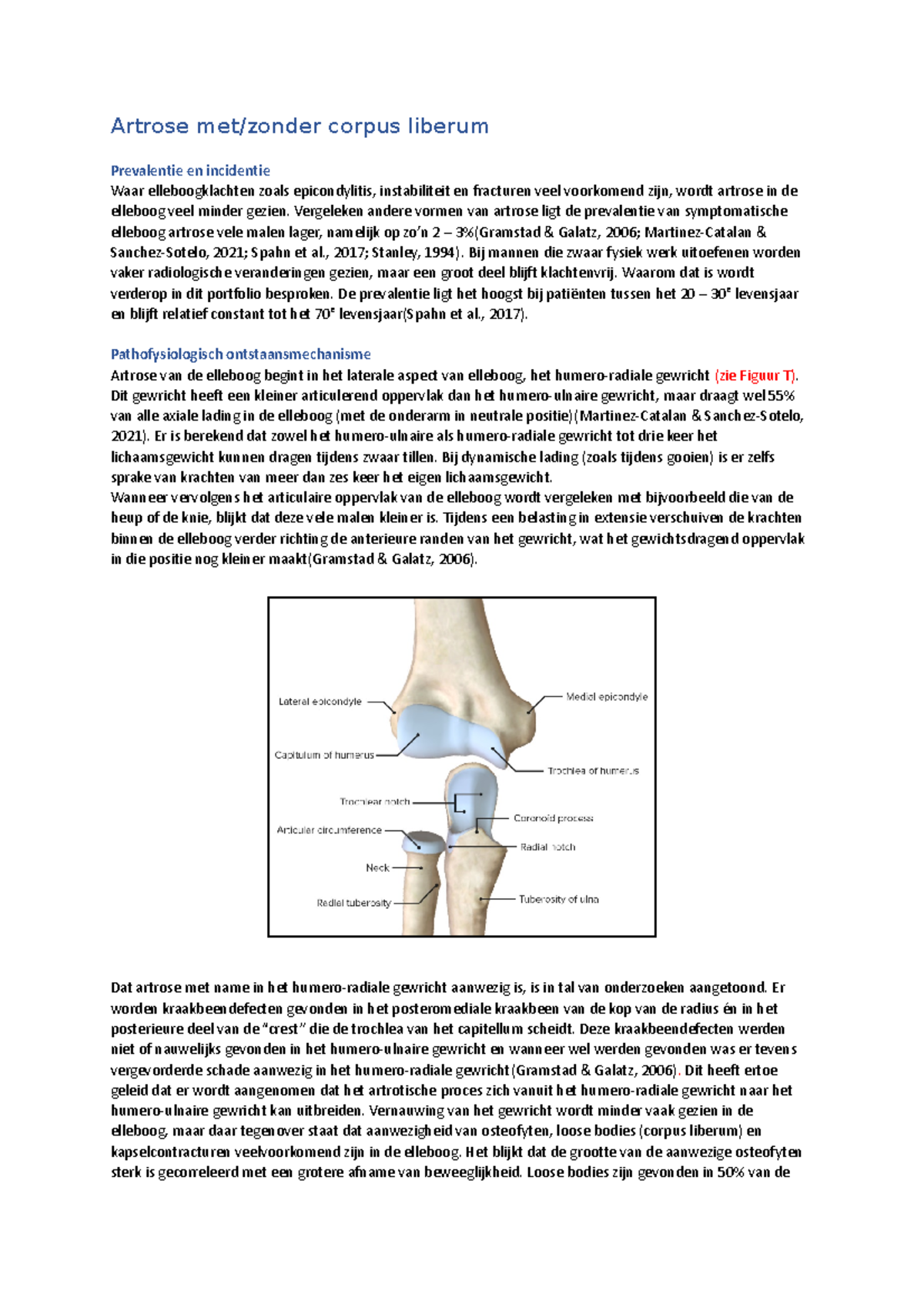 Elleboog artrose met of zonder corpus liberum - Artrose met/zonder ...