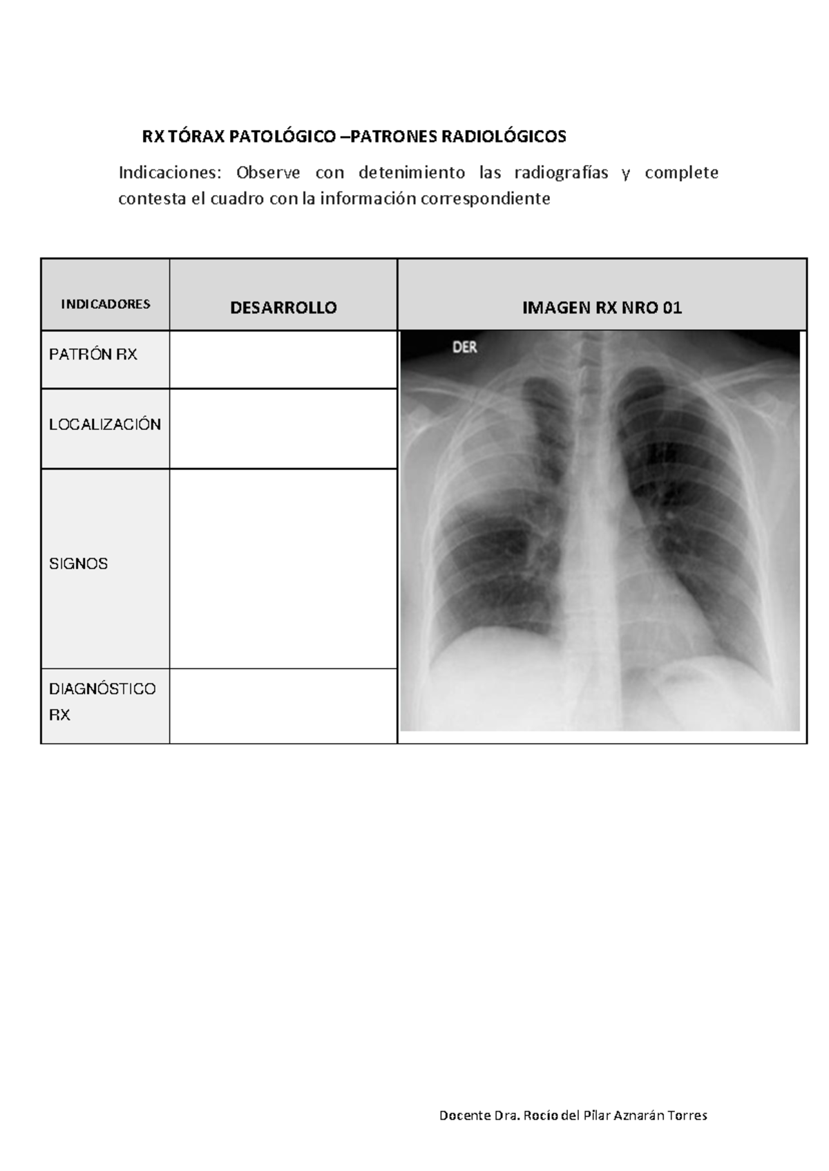 Practica Torax - RX TÓRAX PATOLÓGICO – PATRONES RADIOLÓGICOS ...