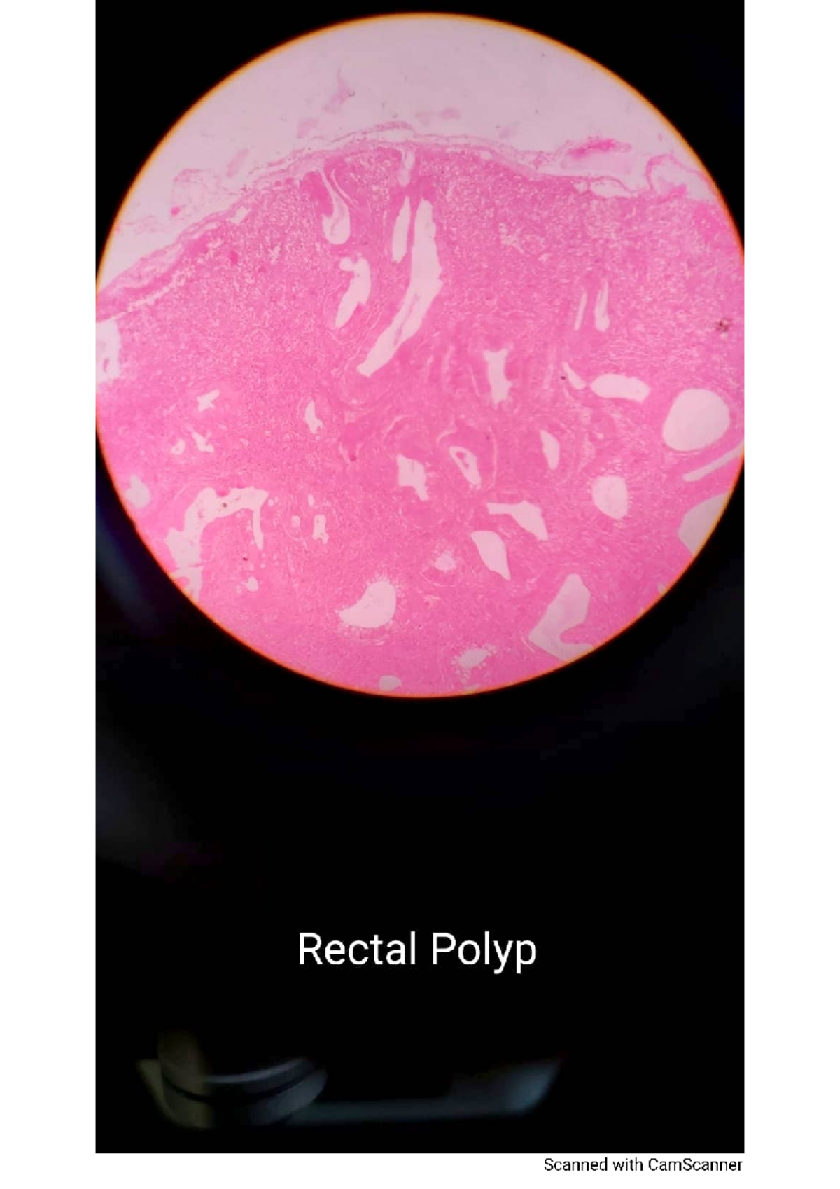 Pathology University Slides - Rectal Polyp Scanned with Rectal Polyp ...