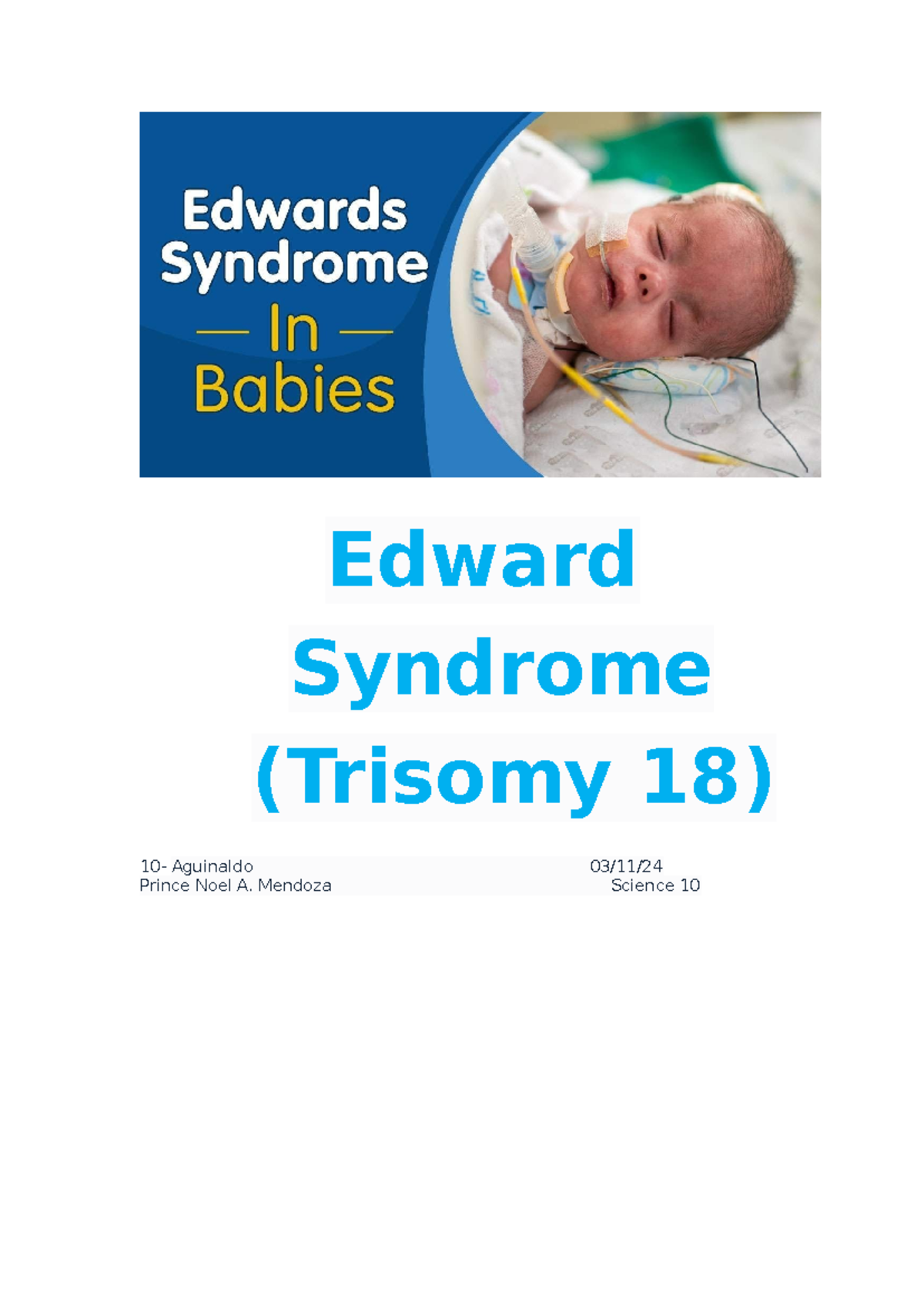 Edward - essay - Edward Syndrome (Trisomy 18) ####### 10- Aguinaldo 03 ...