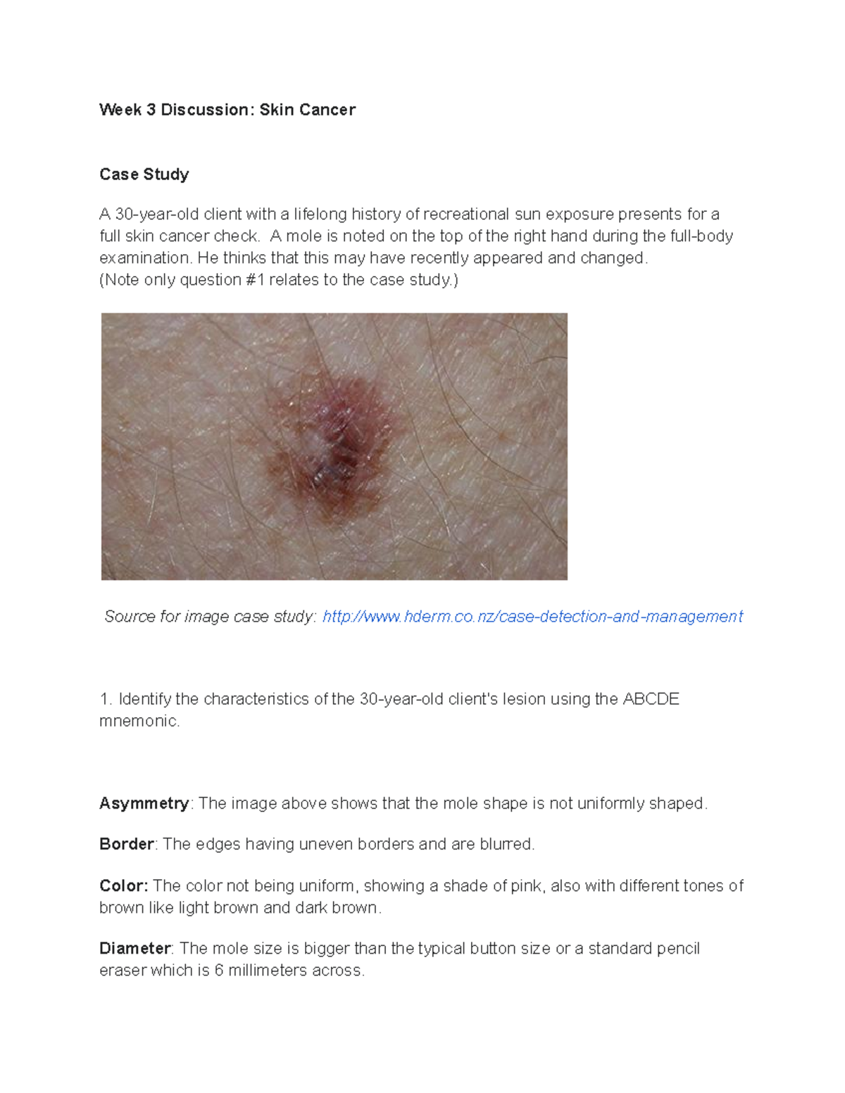 Week 3: Skin Cancer - Week 3 Discussion: Skin Cancer Case Study A 30 ...