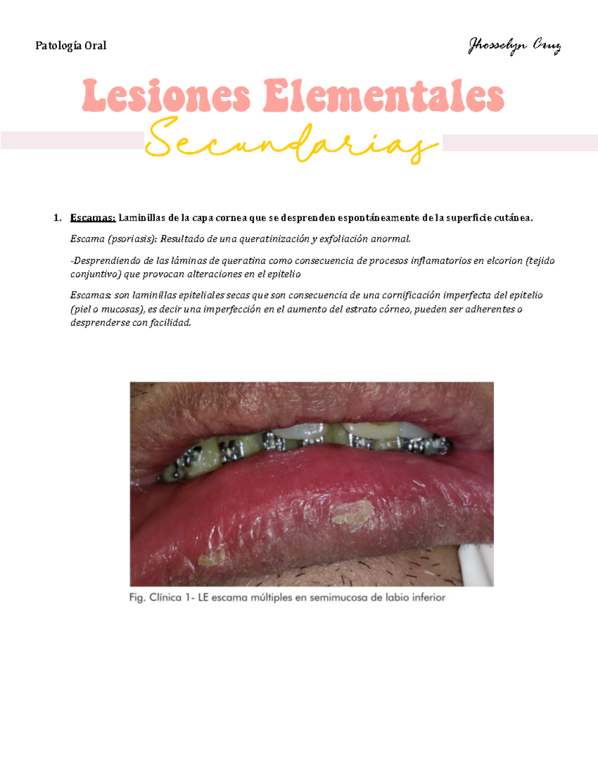 Lesiones secundarias - Escamas: Laminillas de la capa cornea que se ...