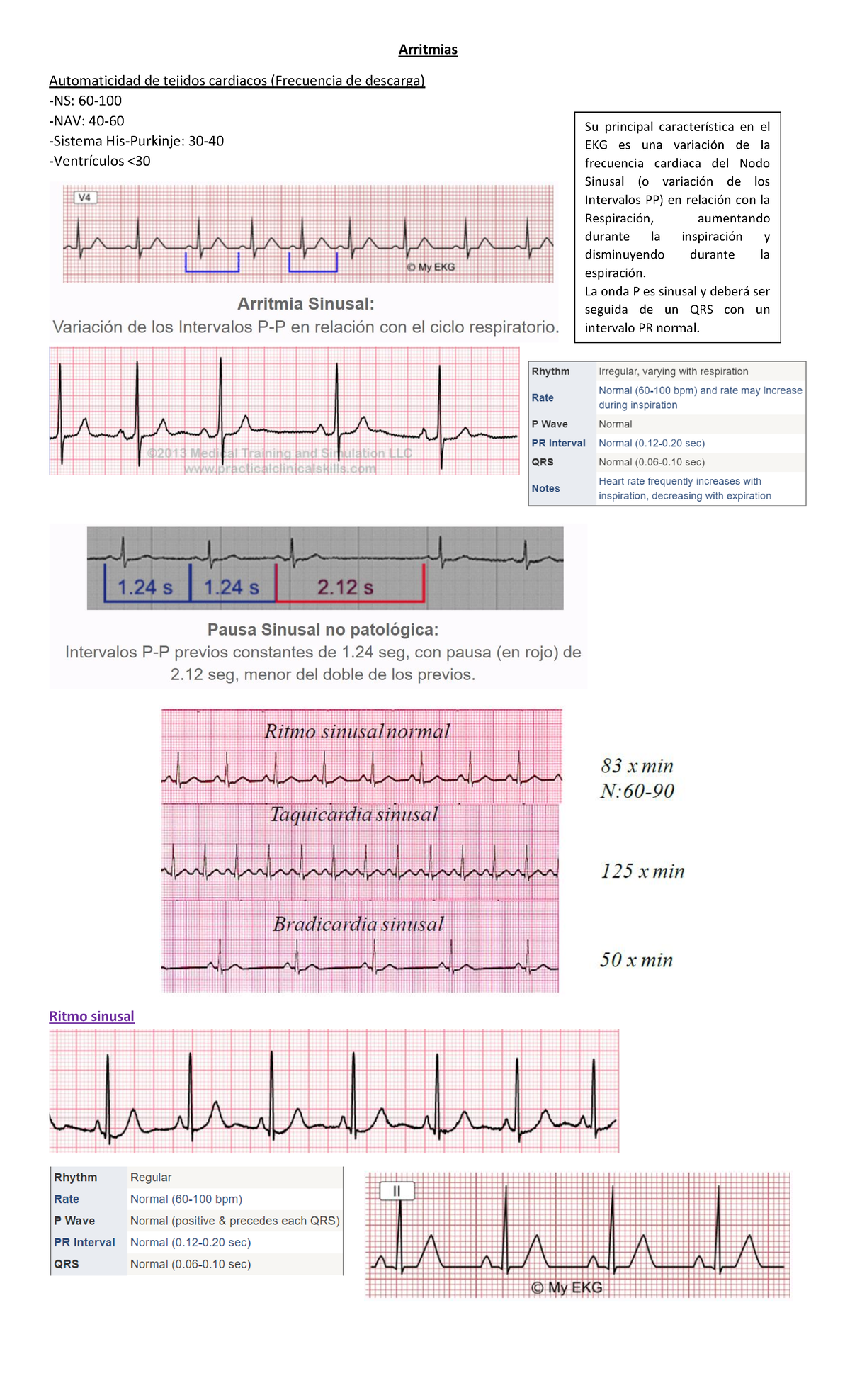 Taquiarritmias de QRS ancho y angosto - Arritmias Automaticidad de ...