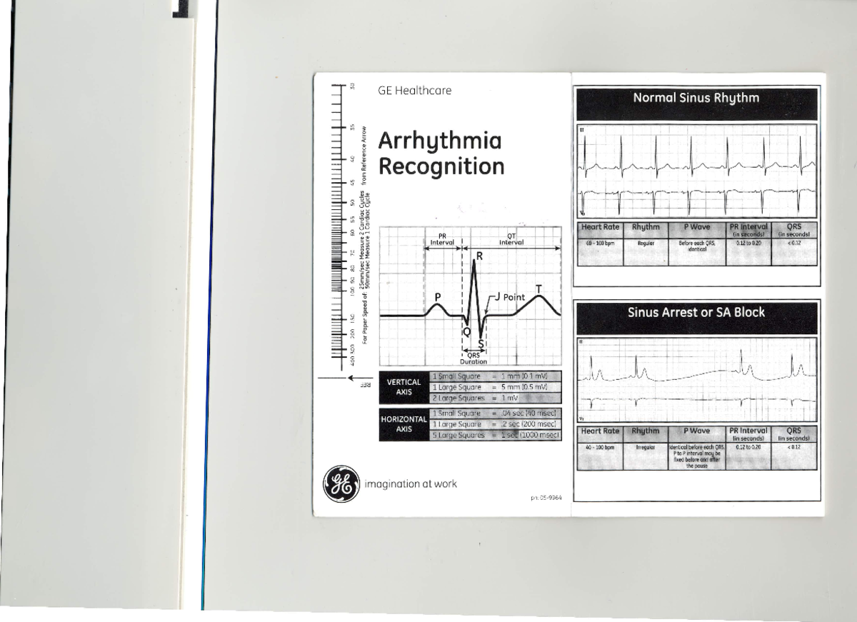 Electrocardiogram (EKG/ECG) Cheat Sheet from GE Healthcare for ...