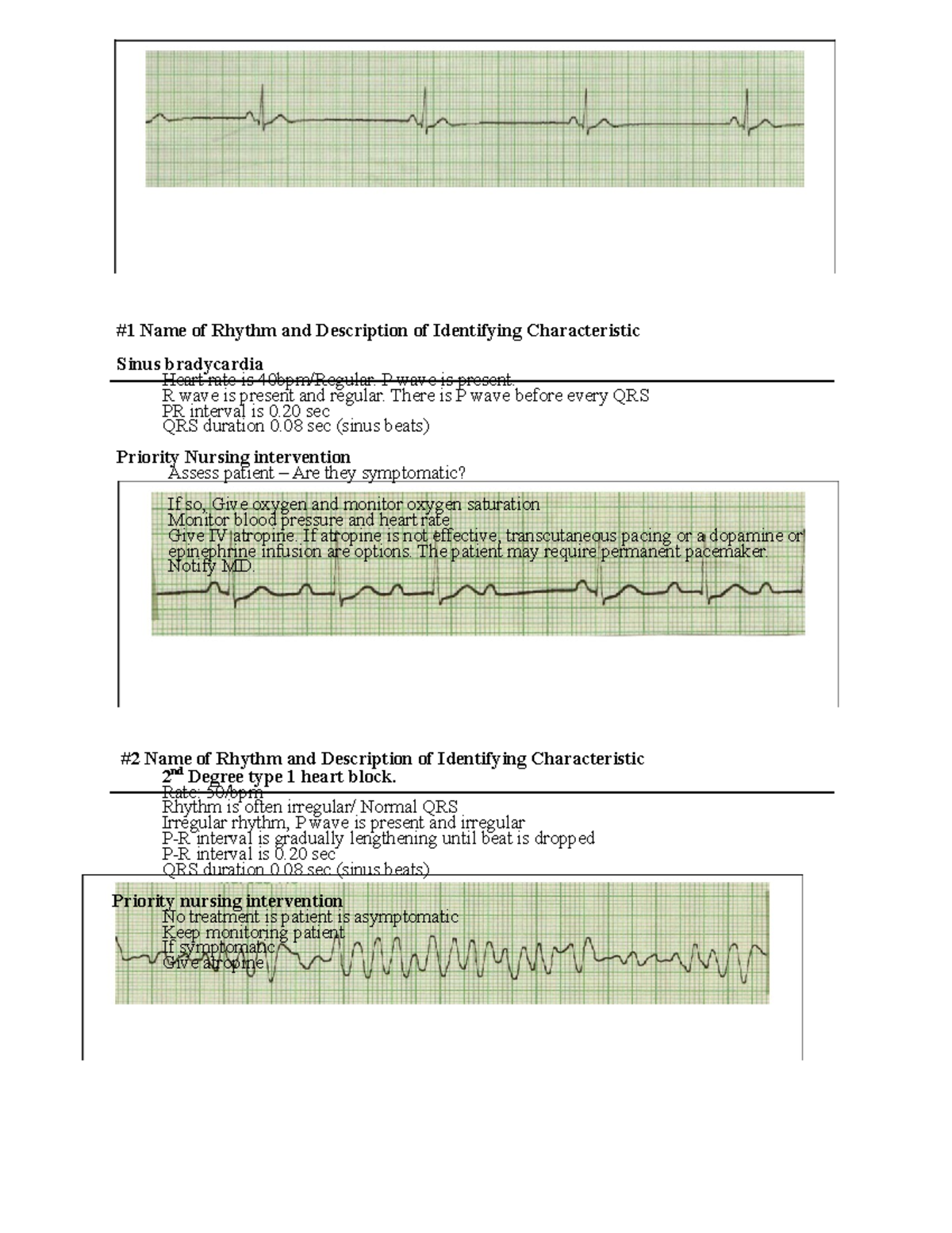 Ekg ans sheets - week 3 ekgs - Sinus bradycardia Heart rate is 40bpm ...