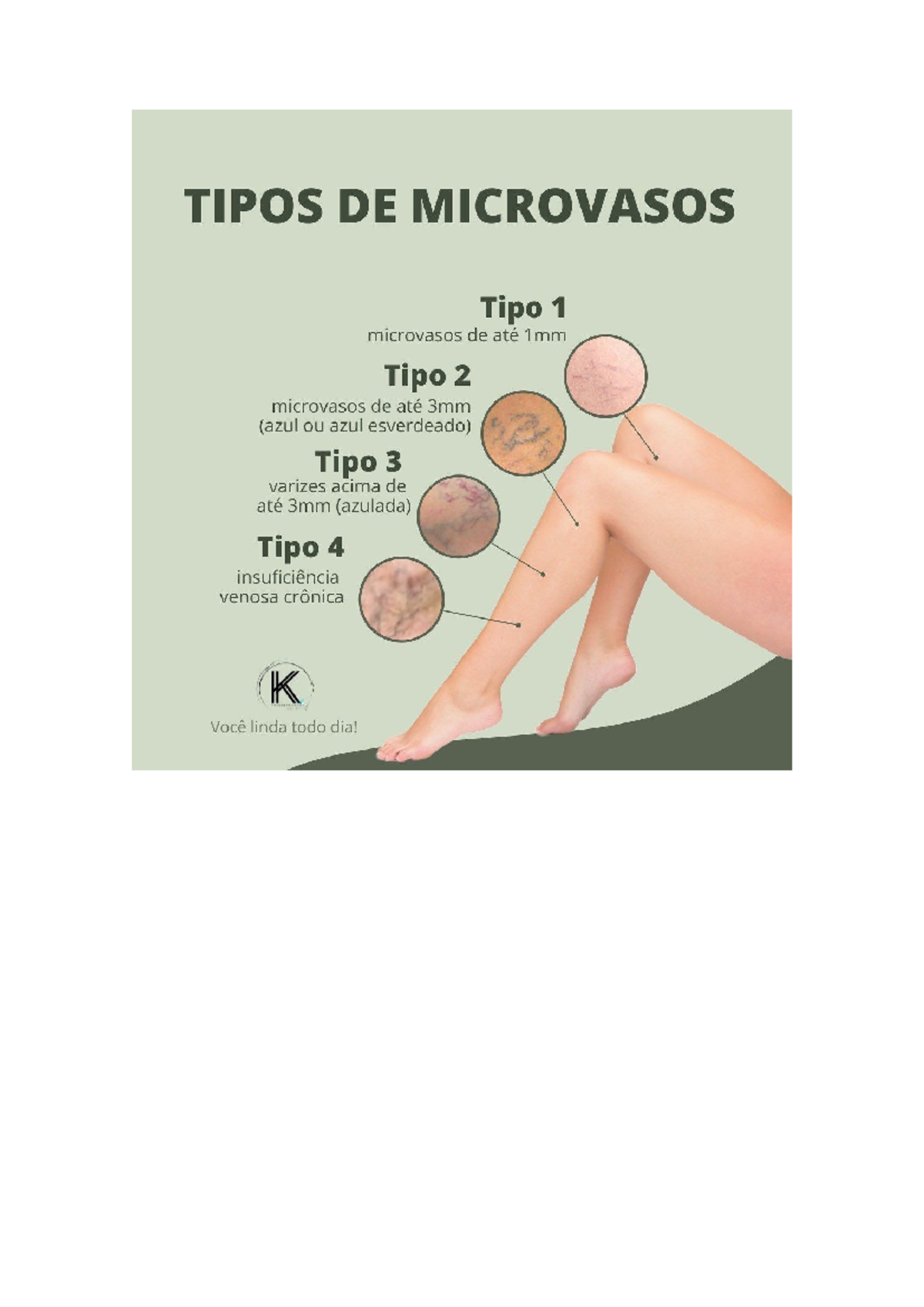 Tipos de microvasos - estudo - Mammography Biomedical - Studocu