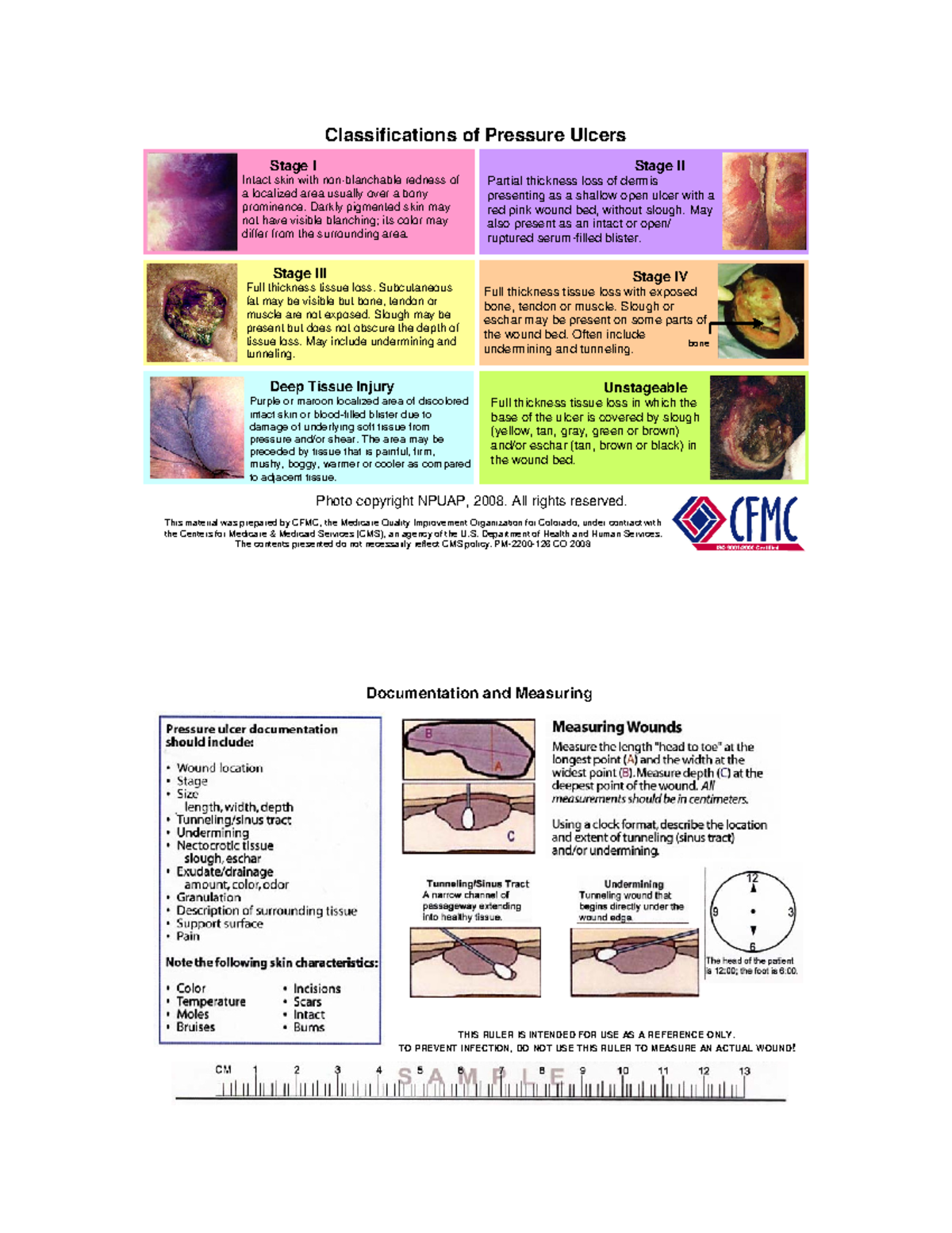 Pressure Ulcer Classifications - Color Version - Classifications of ...
