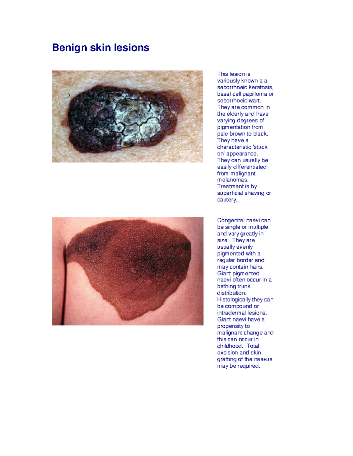 Benign lesions - Lecture notes 1 - Benign skin lesions This lesion is ...