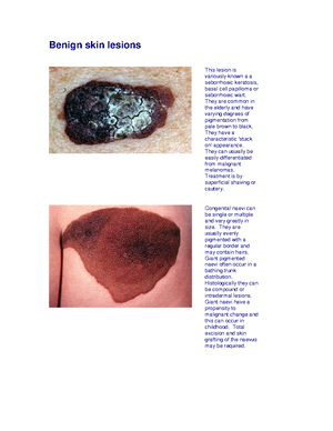 Dermatology - Lecture notes 1 - DERMATOLOGY Dr. N. Shear Blaise ...