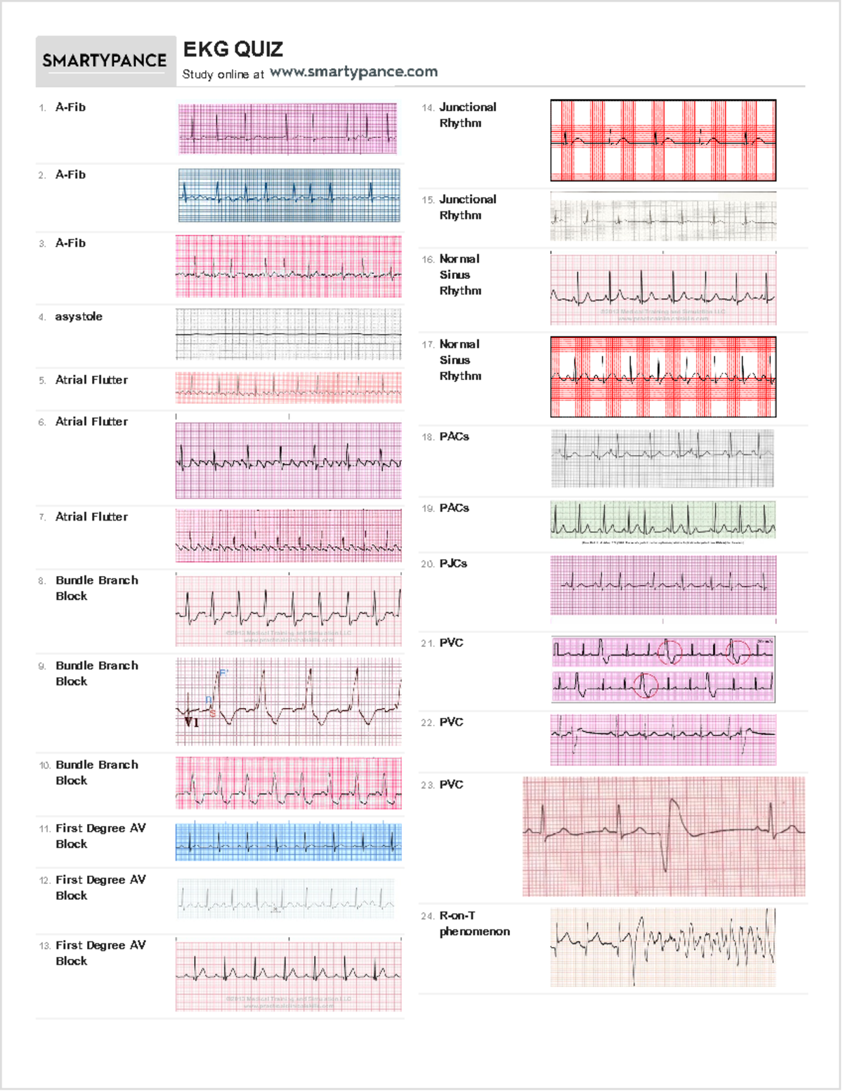 Smartypance AND Panre EKG Quick CRAM - 1. A-Fib 2. A-Fib 3. A-Fib 4 ...