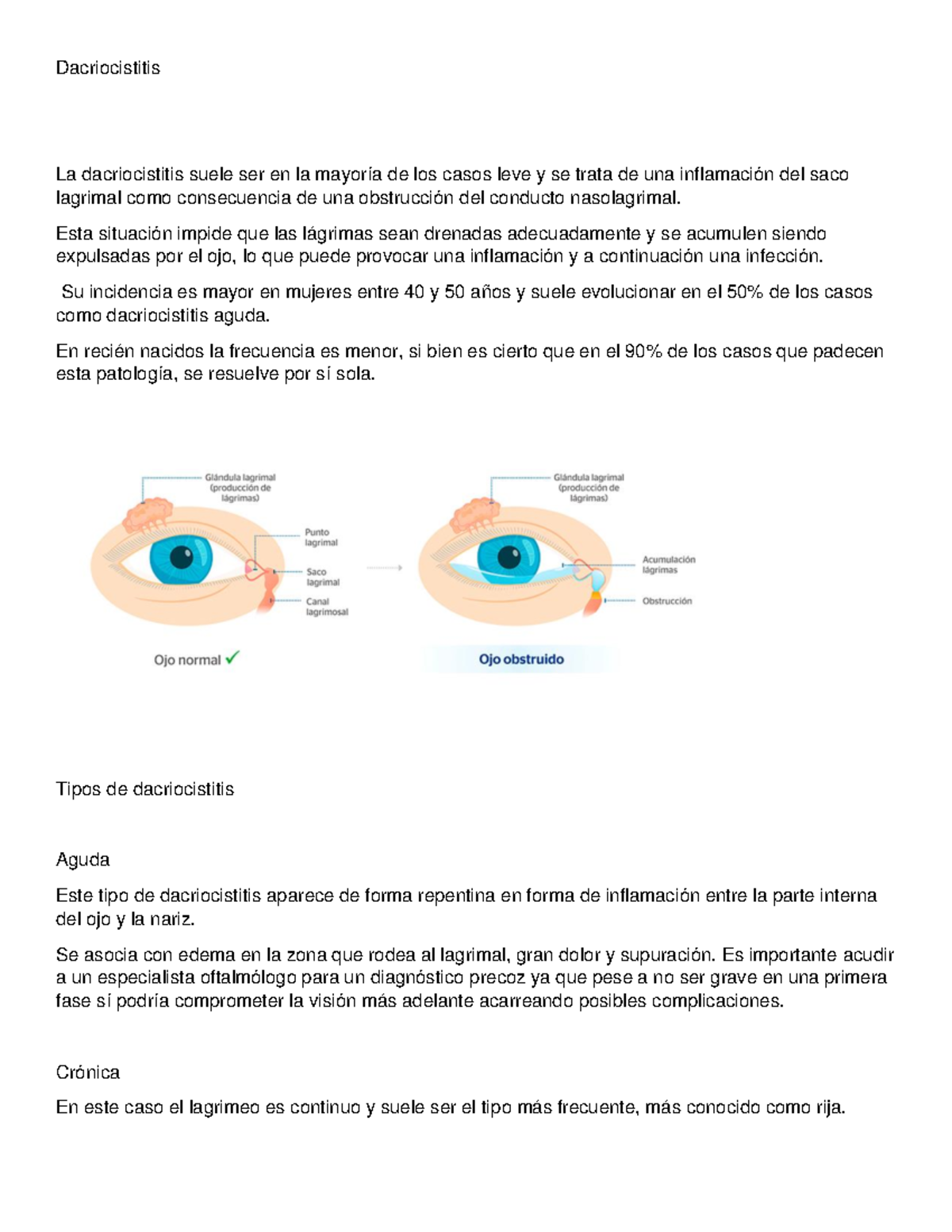 dacriocistitis-la-dacrioadenitis-es-la-inflamaci-n-de-la-gl-ndula-que