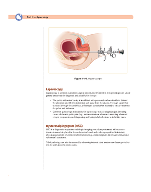 Dilation and Curettage with Hysteroscopy - In this procedure the patient’s cervix will be ...