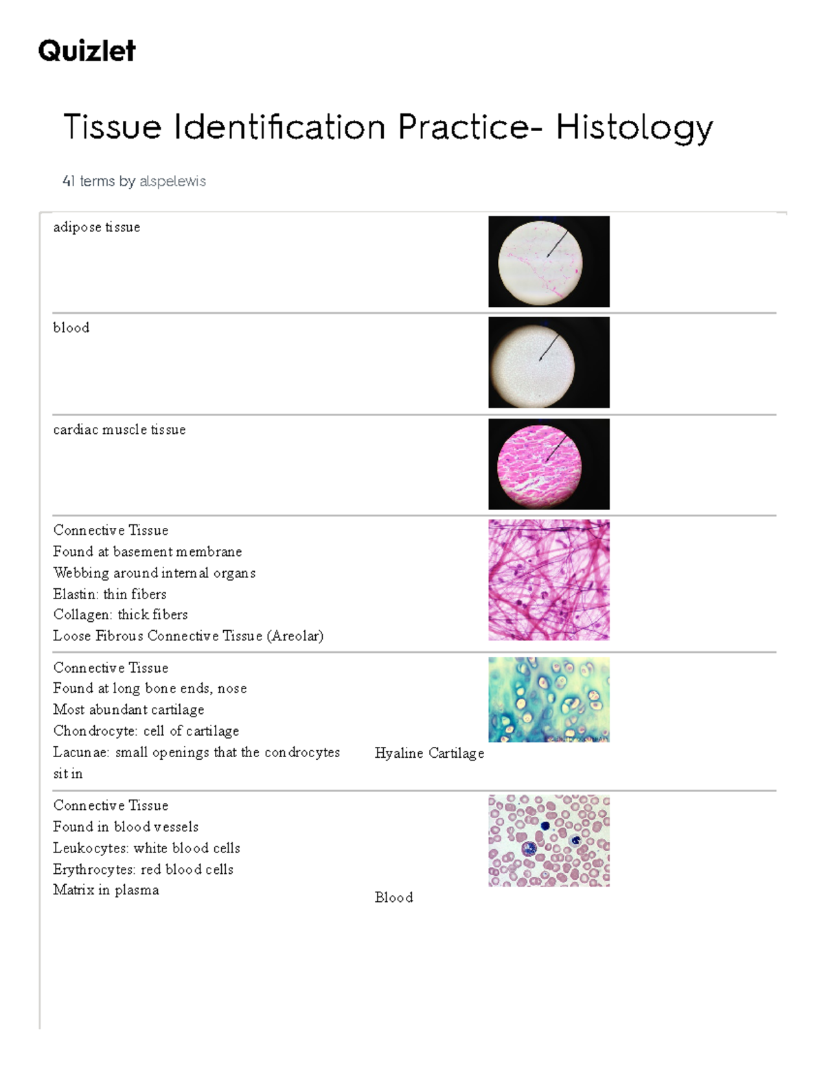 Histology - Flashcards - Tissue Identification Practice- Histology 41 ...