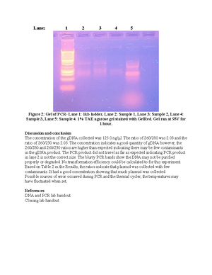 DNA Lab Report - DNA Introduction and purpose DNA extraction from an ...